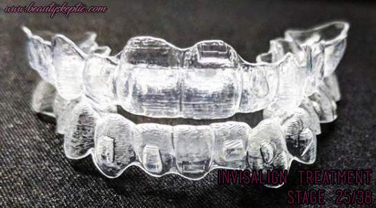 Invisalign Oral Hygiene Series Toothbrushes Beauty Skeptic
